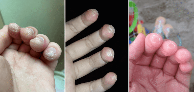 How Long Does It Take To Build Guitar Calluses?